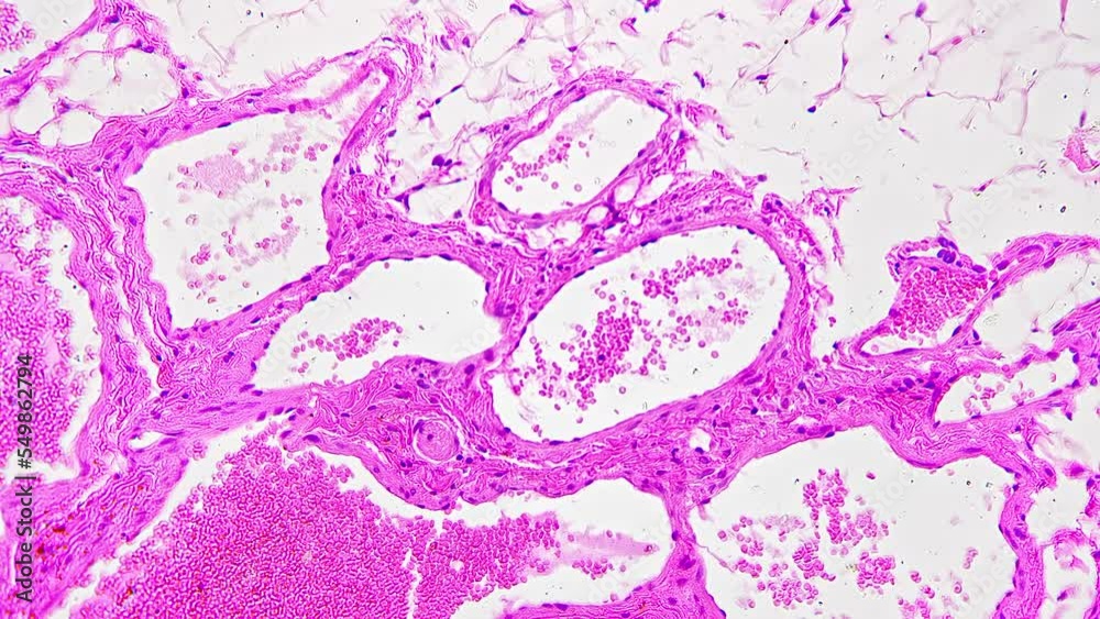 Intestine in longitudinal section magnified under microscope 200x ...