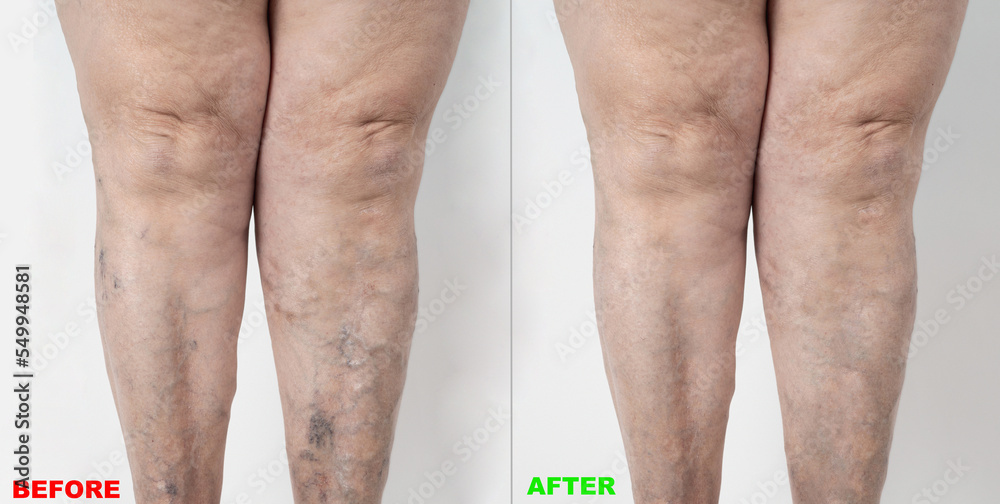 detail of one with smooth and beautiful legs of an elderly person, with ...