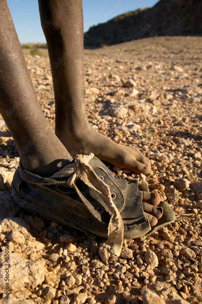 Himba boy with one worn out shoe, Namibia. Stock Photo | Adobe Stock