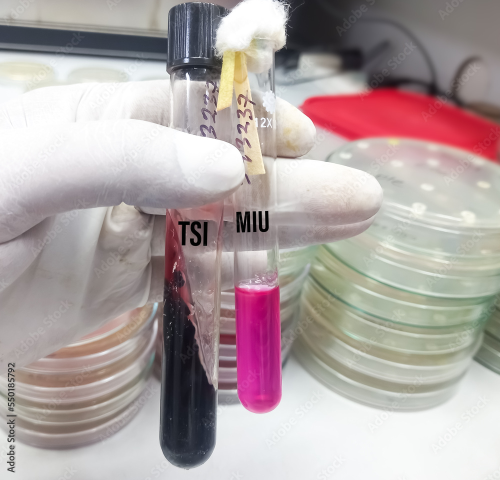 Biochemical test for gram negative bacteria (TSI, Motility and Indole ...