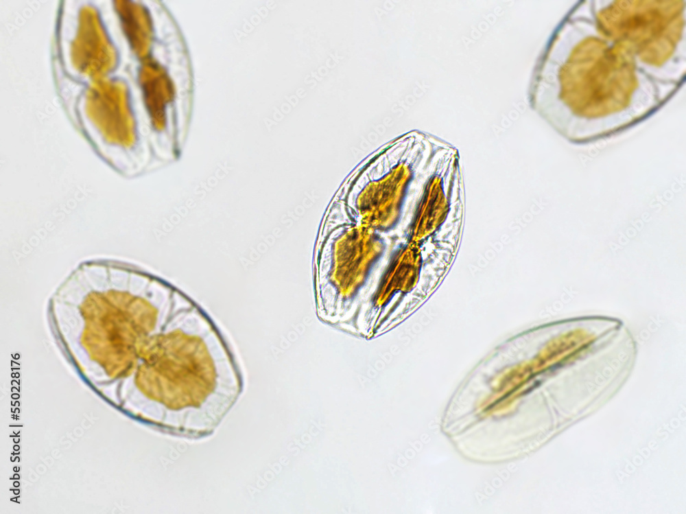Amphora sp. algae under microscopic view, Diatoms, phytoplankton ...
