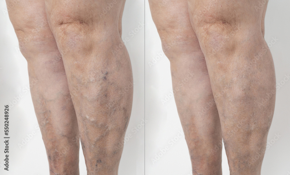 detail of one with smooth and beautiful legs of an elderly person, with ...