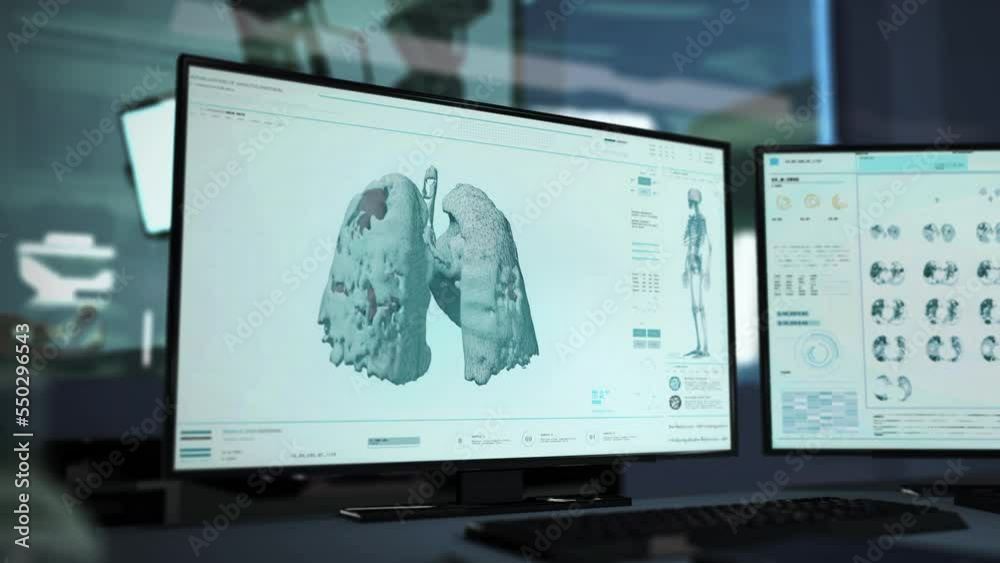 High Tech Medical Software Diagnosed Cancer During Scan Of Patients ...