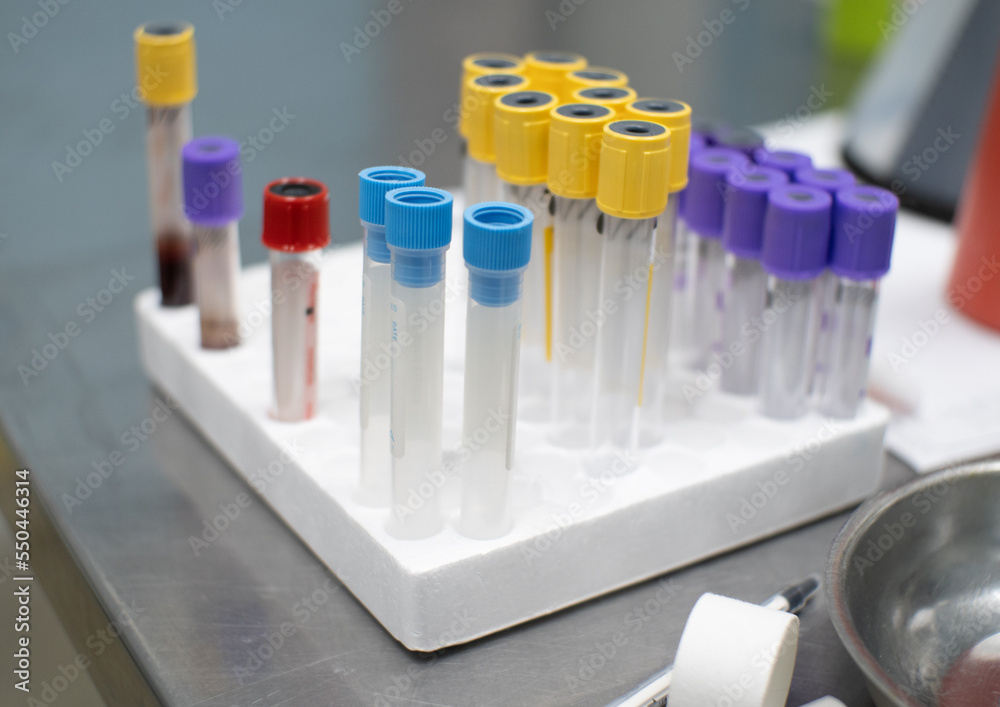 There are test tubes for blood samples on a stand in the laboratory ...