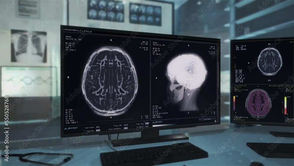 X-ray diagnostic of the human brain at the clinic. X-ray equipment ...
