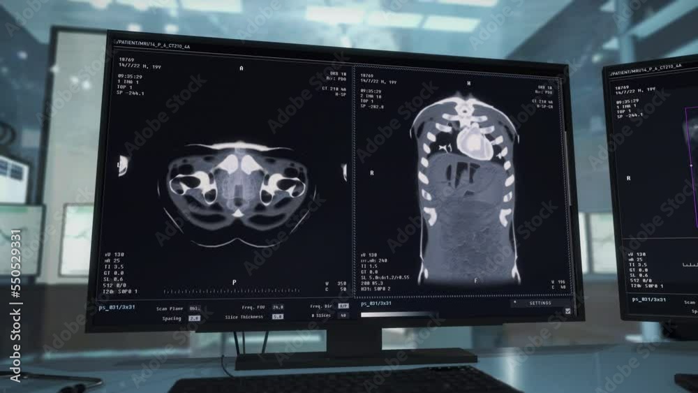 Imaging technology examining the patient body for injury treatment at a ...