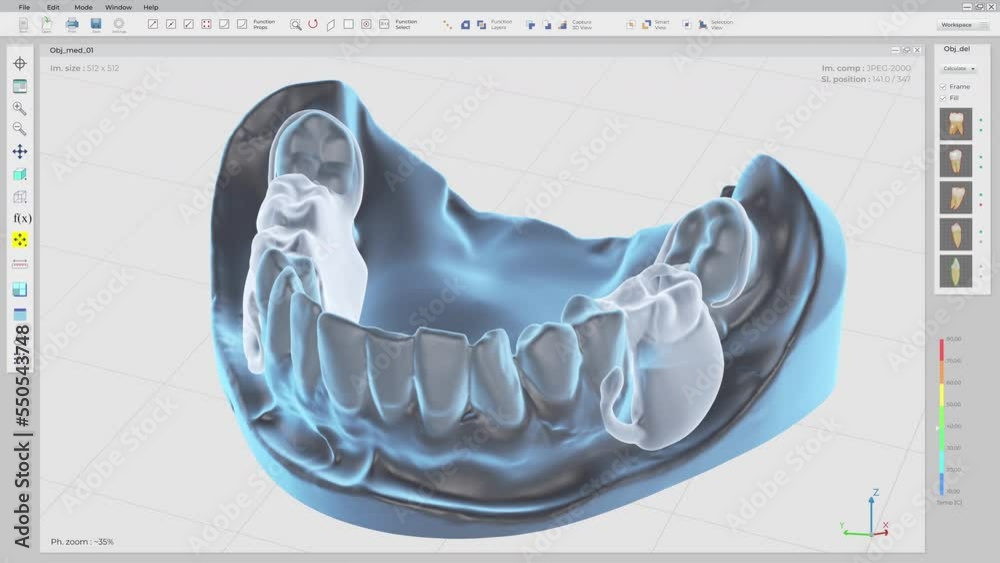 Development of the teeth restoration in the new computer system ...