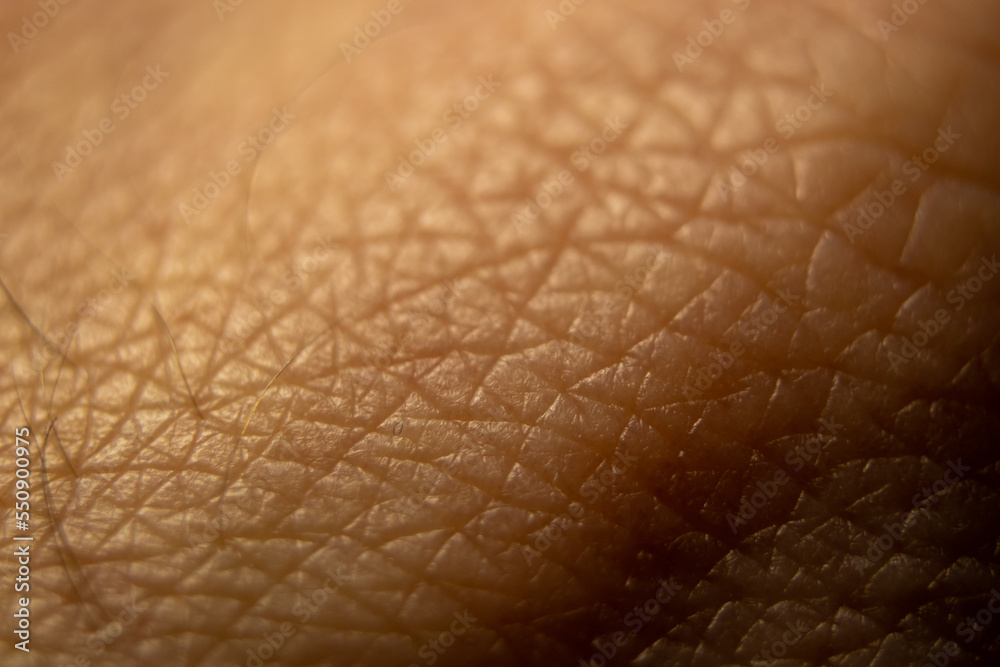 Human skin, dermatilis. Dermatology surface orange pattern. Natural ...