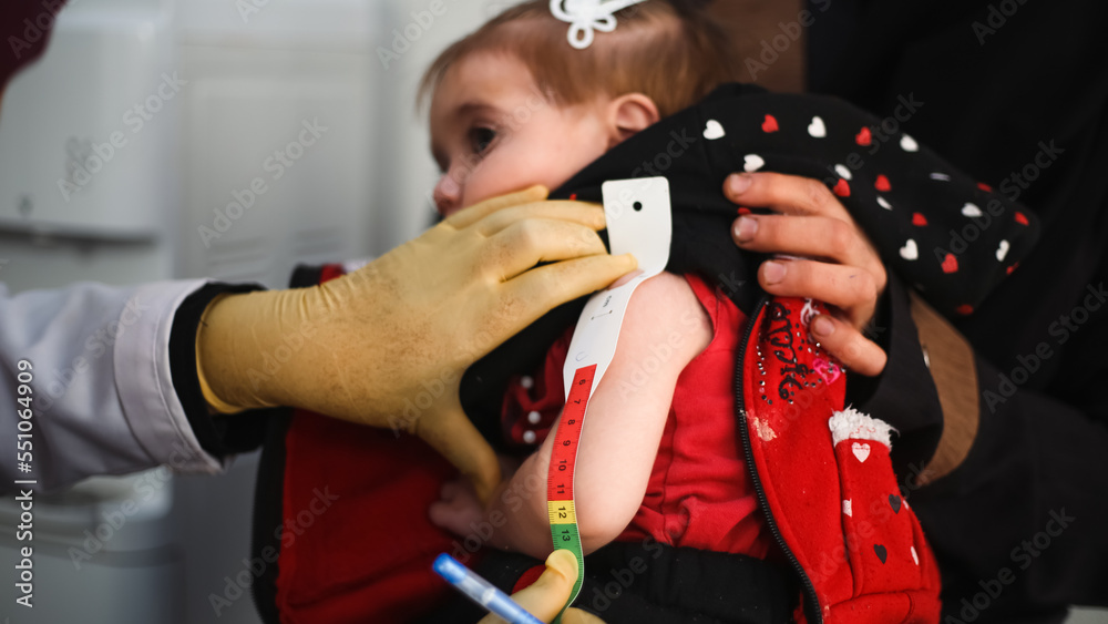 Doctor examines child malnutrition. Measuring malnutrition using strap ...
