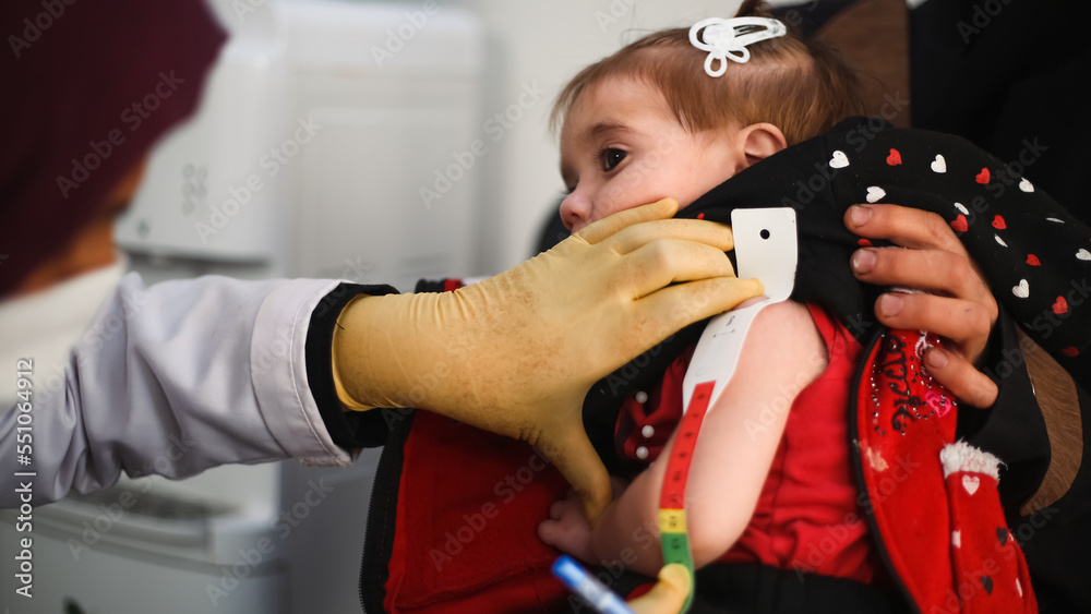 Doctor examines child malnutrition. Measuring malnutrition using strap ...