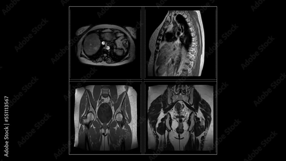 MRI scan screen animation. Computed medical tomography MRI. Diagnosis ...