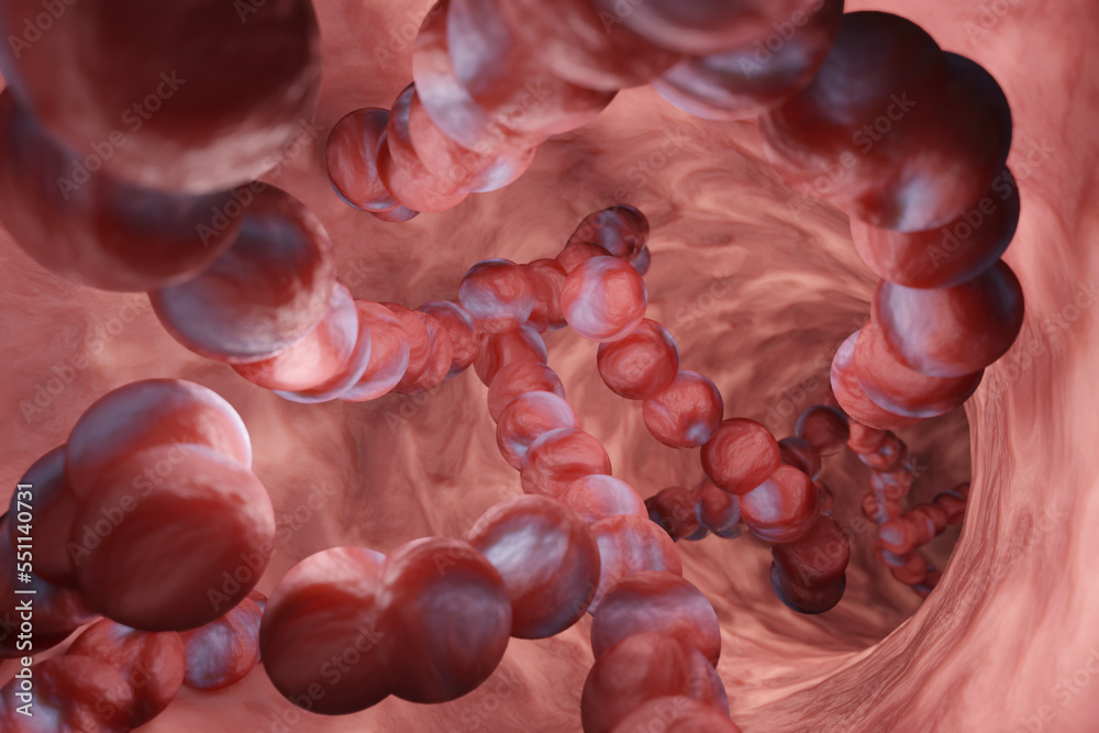Strep A bacterial structure in a throat. Illustration of the infection ...