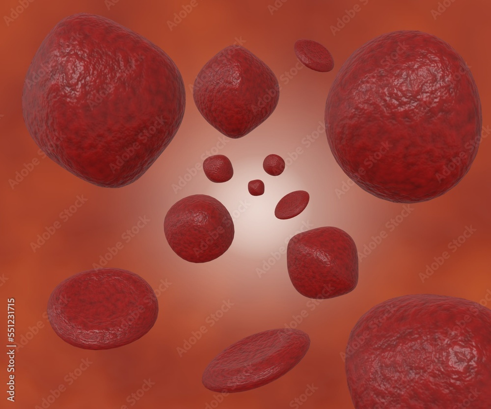 Macrocytosis is a condition in which your red blood cells are larger ...