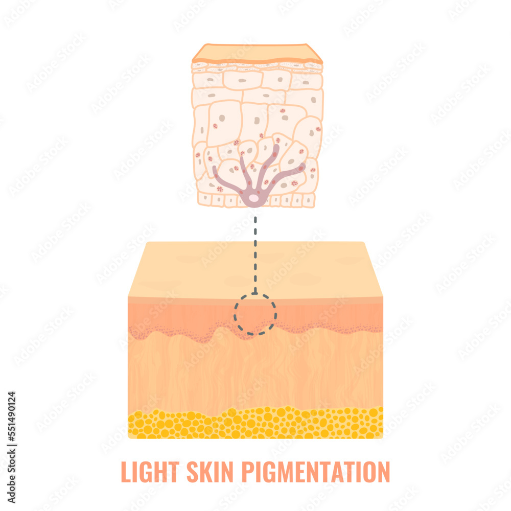 Melanin content and distribution in light skin. Fair complexion ...