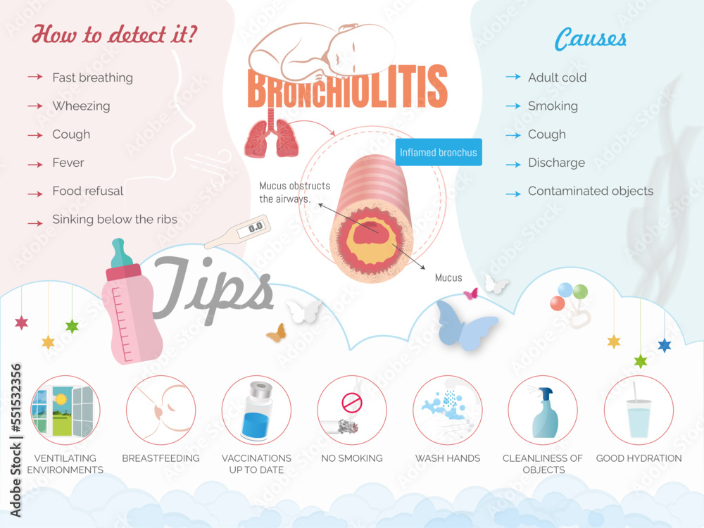 Infographic of bronchiolitis, how to detect it, symptoms and tips with ...