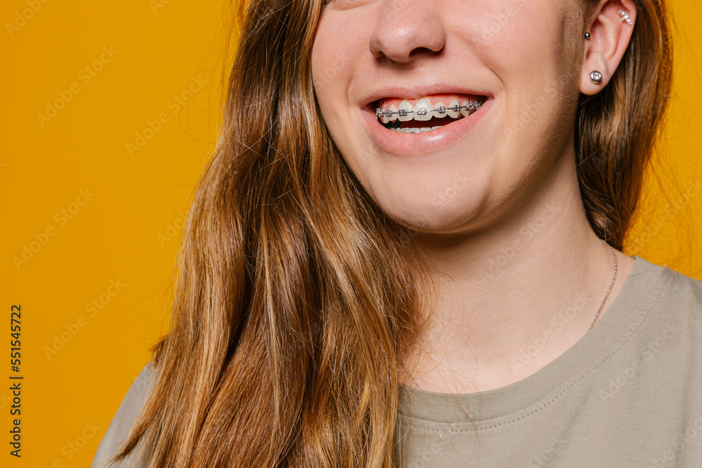 Smiling girl with brackets with long hair in studio Stock Photo | Adobe ...