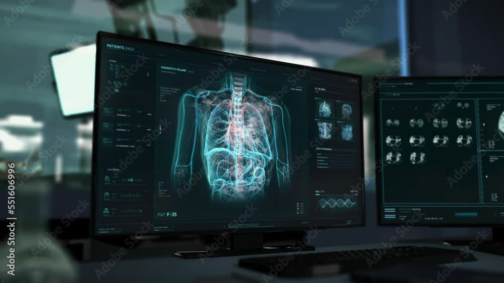 Stockvideon Molecular analysis system is diagnosing patient with cancer ...
