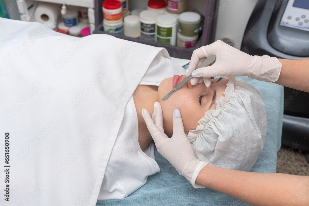skin treatment with the dermaplaning technique performed with a scalpel ...