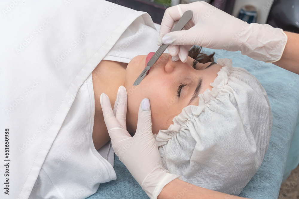 skin treatment with the dermaplaning technique performed with a scalpel ...
