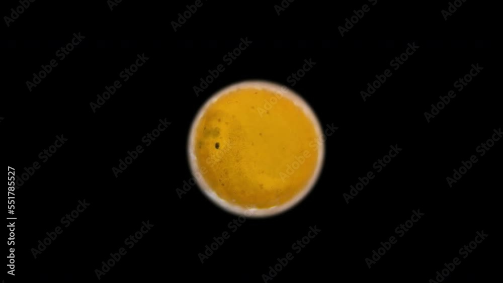 Movement of the embryo in the egg of the worm Pentacoelum sp. under the ...