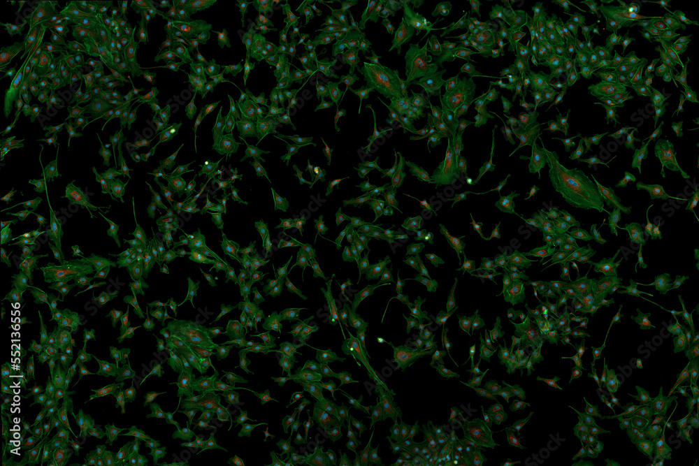 Microfilaments, nuclei, and mitochondria of fibroblasts Stock ... Microfilaments, nuclei, and mitochondria of fibroblasts Stock ...
