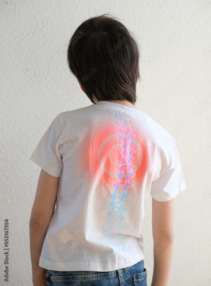 part of naked back of boy, child 10 years old in a white t-shirt bent ...