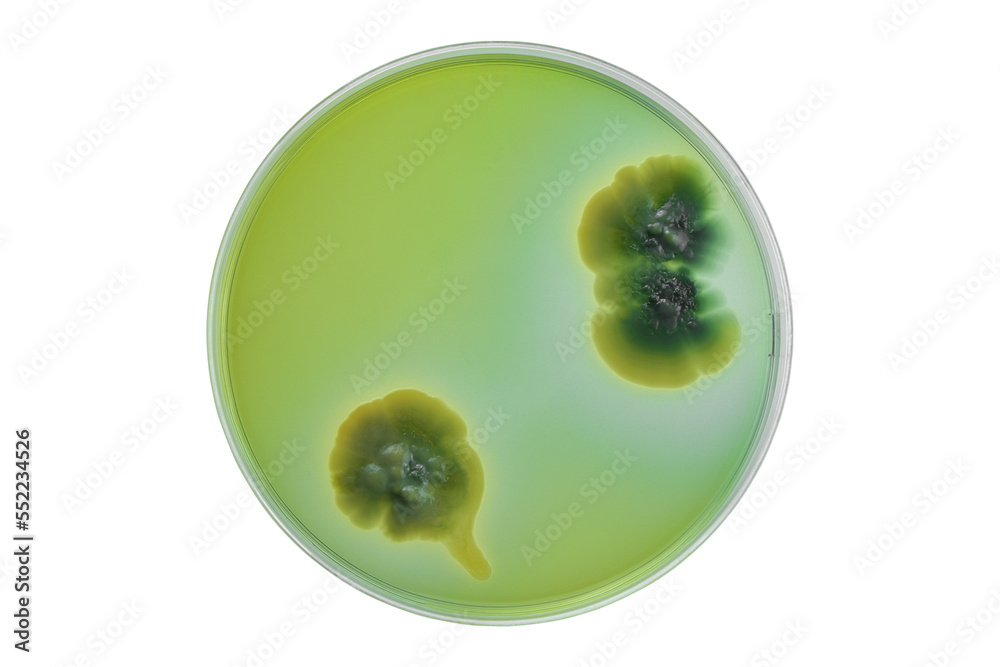 Petri dish or culture media with bacteria on white background with ...