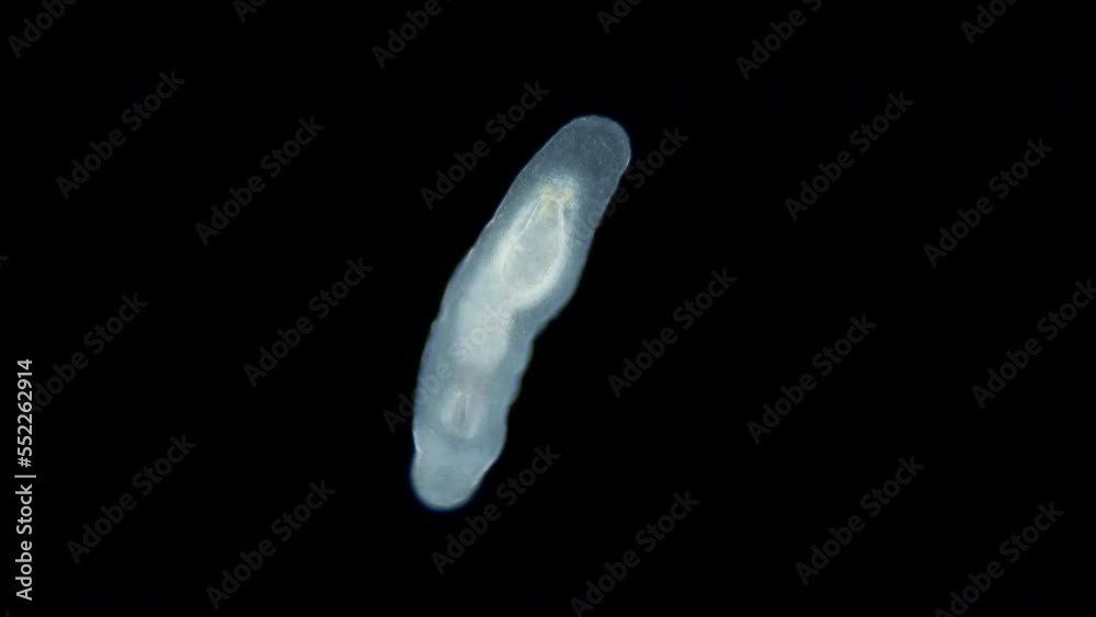 Flatworm Macrostomum sp. under a microscope, of the family ...