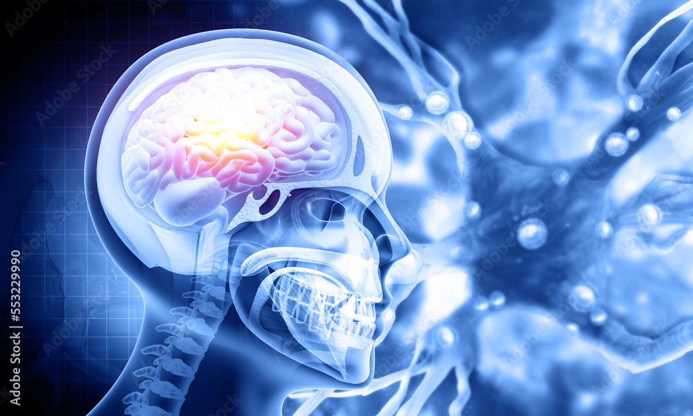 medically accurate illustration of a painful brain, Man with a headache ...