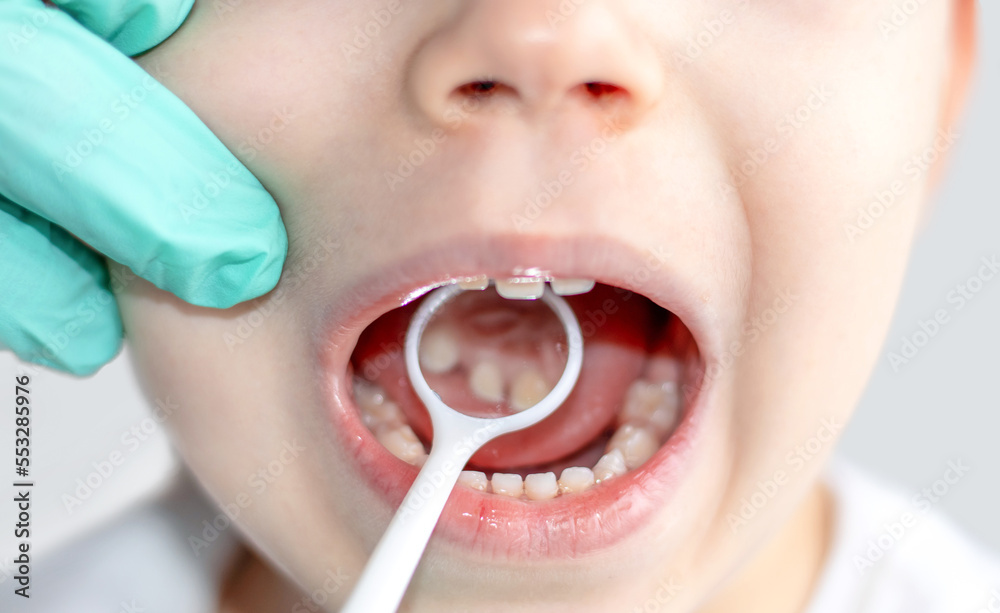 pediatric dentist dental check up happy smiling kid preschooler boy and ...