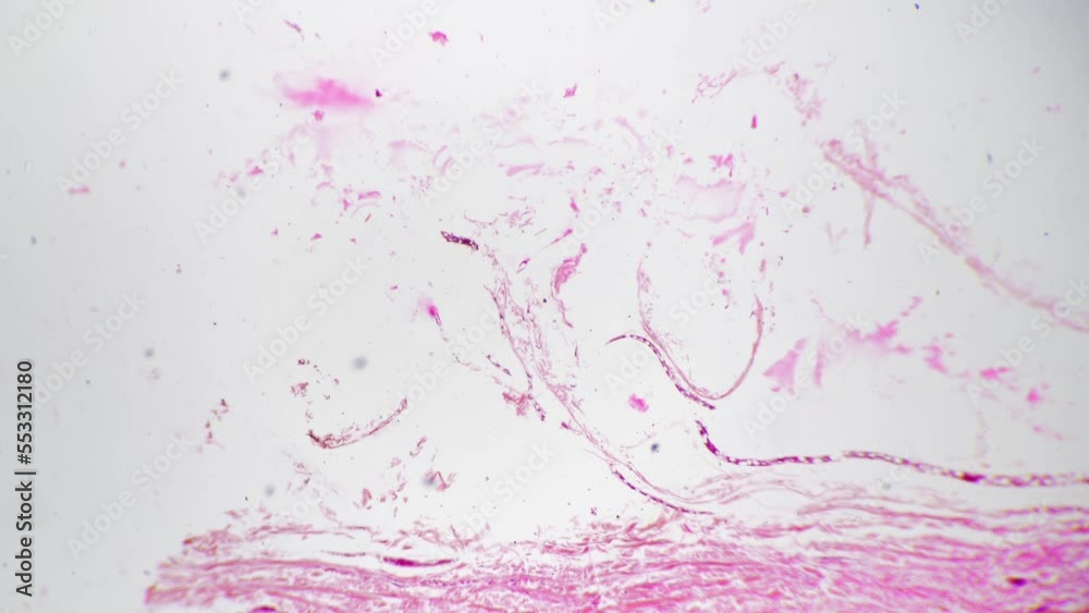 Section of human skin magnified under microscope 40x and filmed on ...