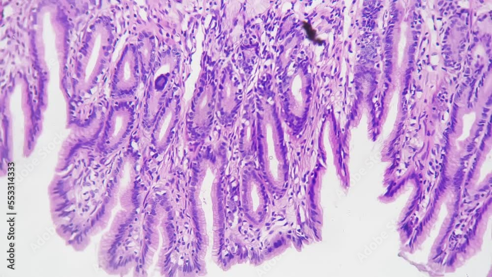 Microscopic footage of pyloric region in section magnified in 200 times ...