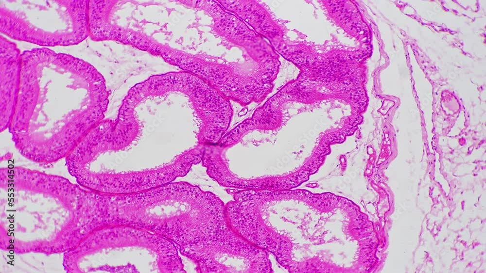 Epididymis in section filmed under microscope and magnified in 100 ...