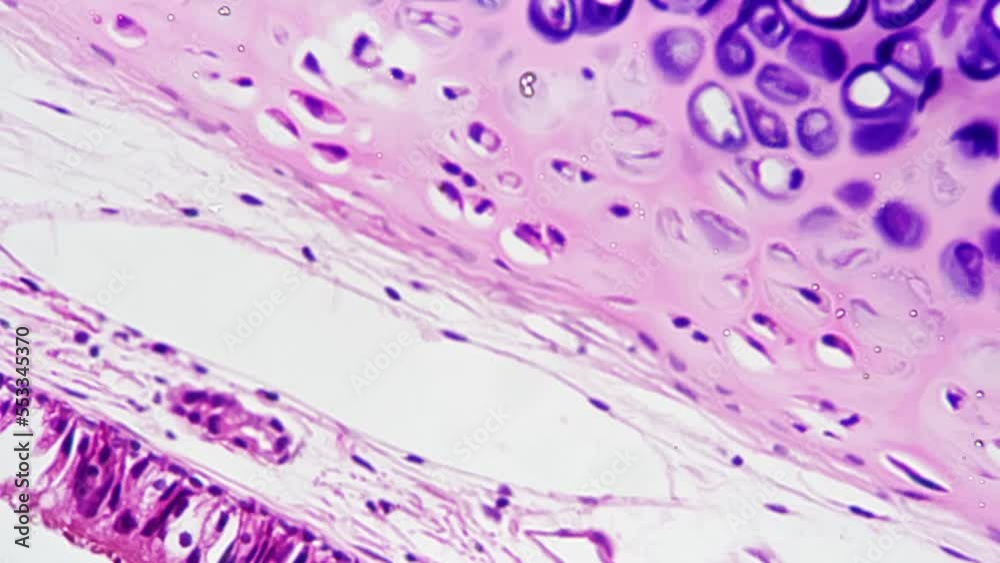 Human trachea in section magnified 400x under microscope against bright ...