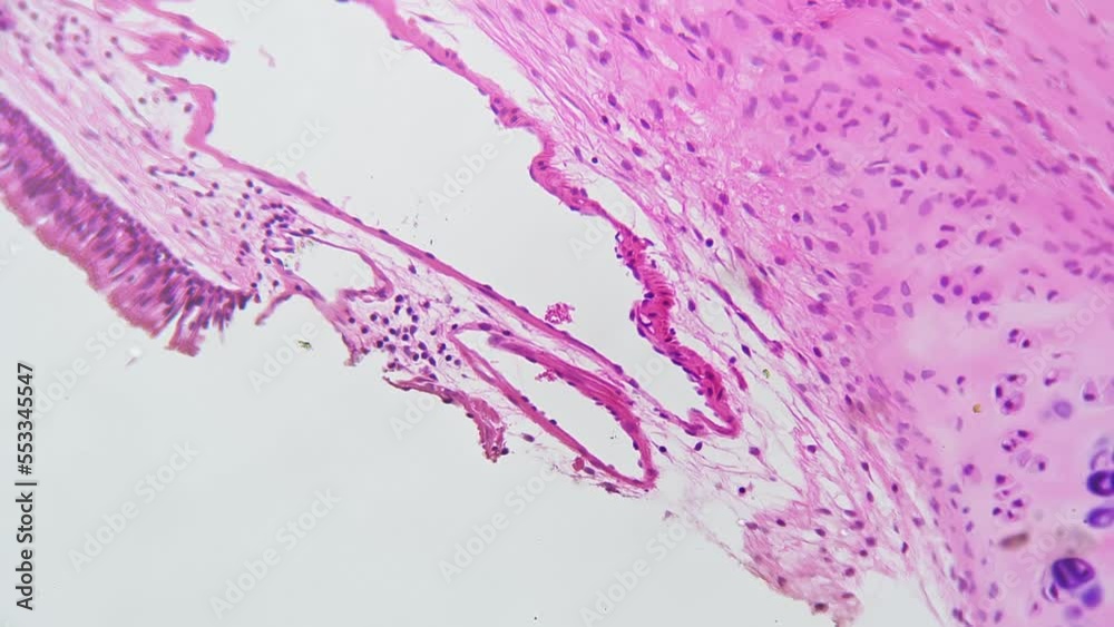 Macro view of human bone cells under microscope 200x against white ...