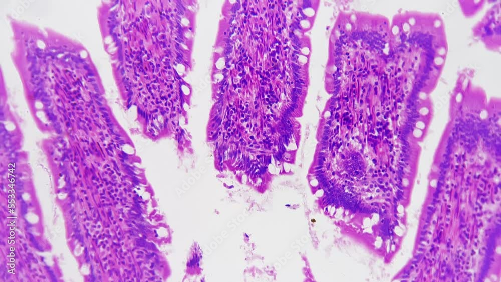 Cross section of small intestine magnified under microscope in 200 ...