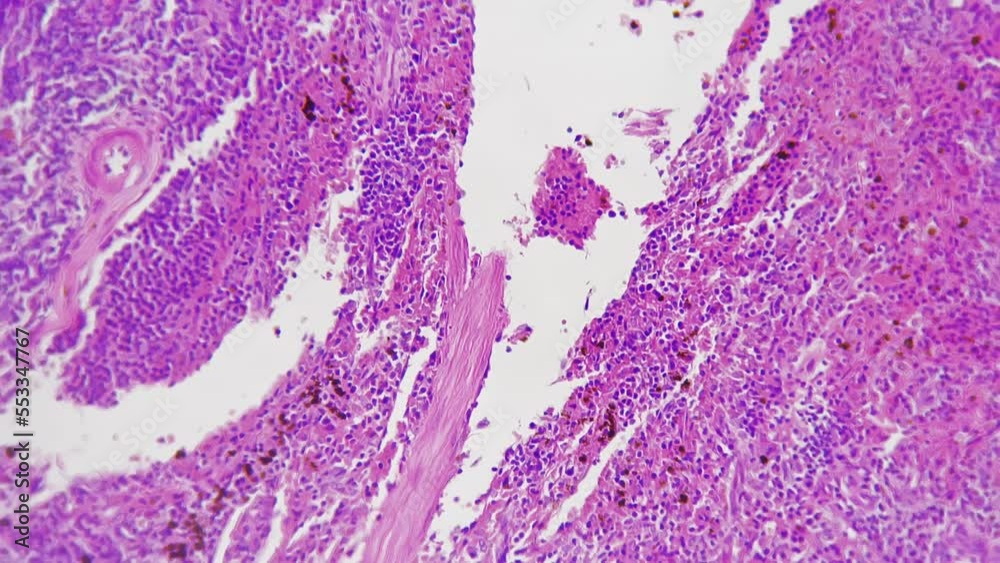 Spleen of human being in section magnified in scientific laboratory ...