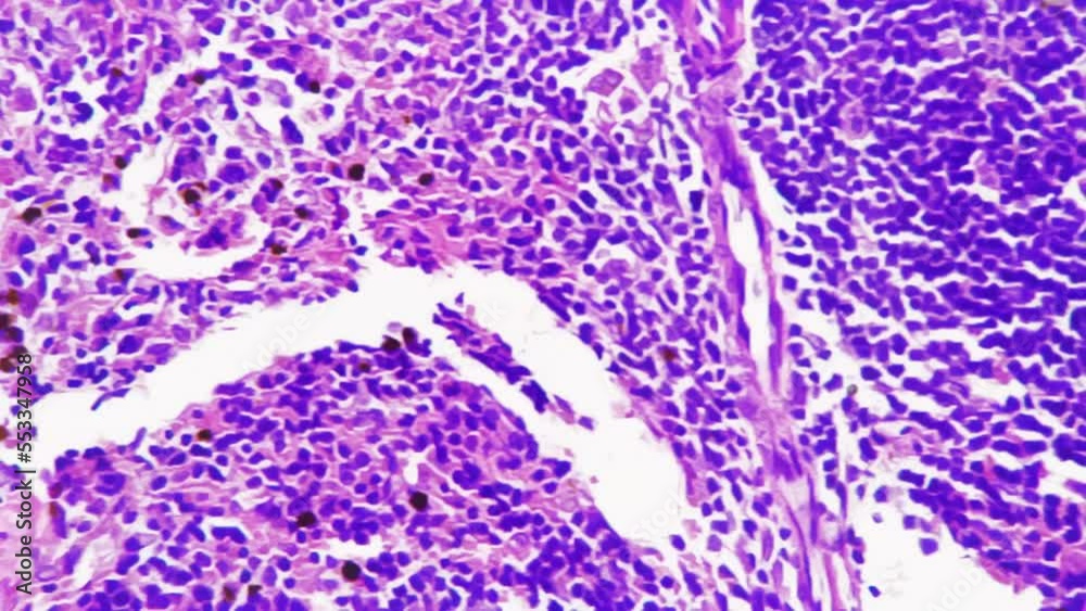 Spleen of human in section magnified in scientific laboratory under ...