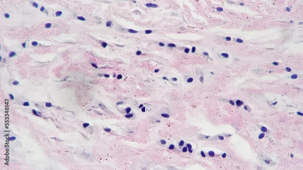 Teased human tendon in cross section magnified under microscope in 400 ...