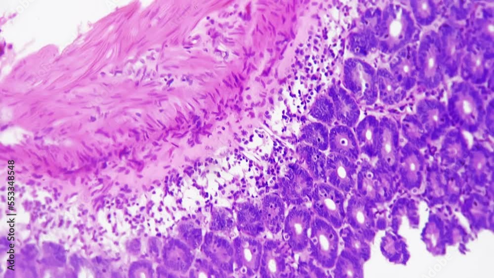 Small human intestine in cross section magnified under microscope in ...