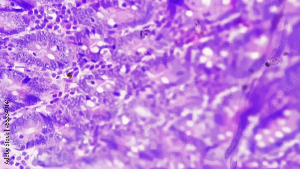 Section of simple columna epithelium filmed under light micrograph 400x ...