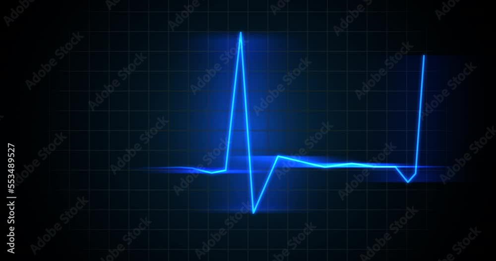 Heartbeat monitor animation. A smooth animation in high quality on a ...