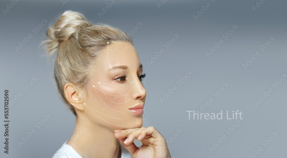 Thread Lift ,markup,technique for performing nonsurgical lifting ...