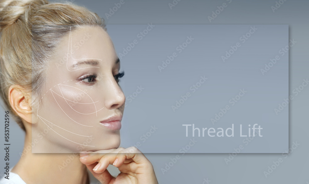 Thread Lift ,markup,technique for performing nonsurgical lifting ...