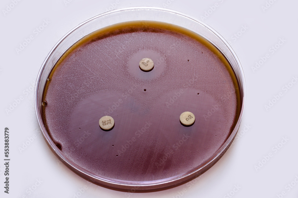 antibiogram of Neisseria gonorrhoeae on GC Agar Stock Photo | Adobe Stock