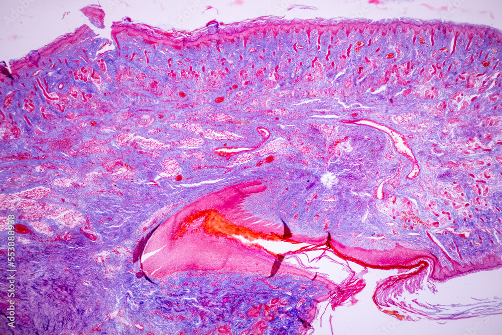Developing of nail, human embryo under the microscope in Lab. Stock ...