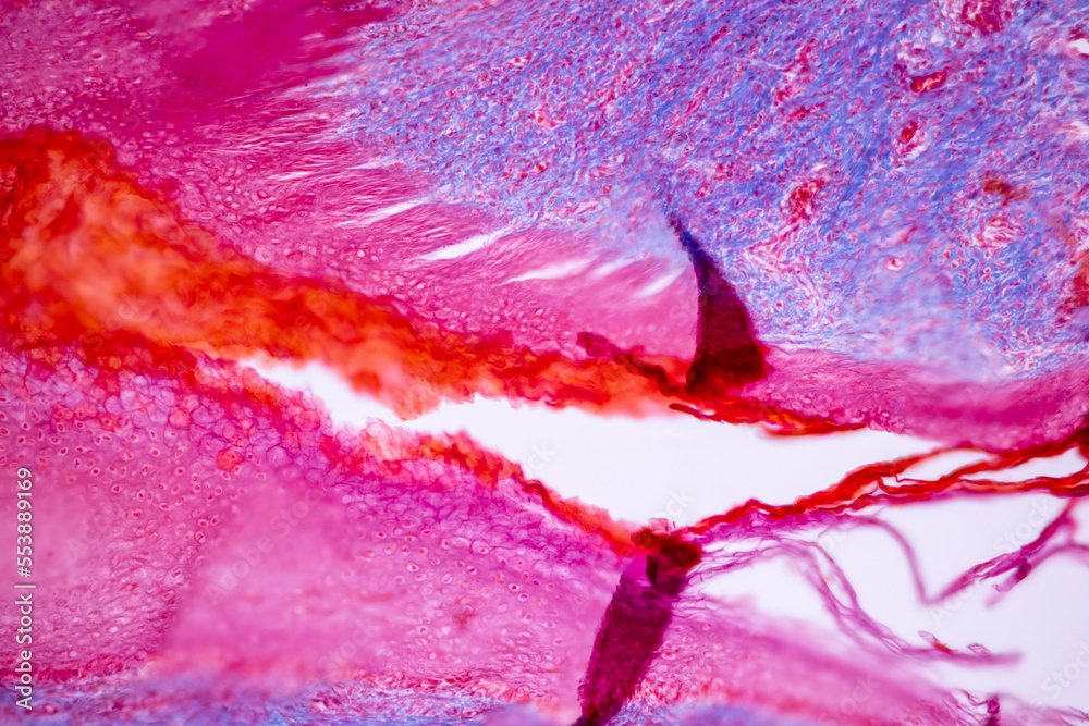 Developing of nail, human embryo under the microscope in Lab. Stock ...