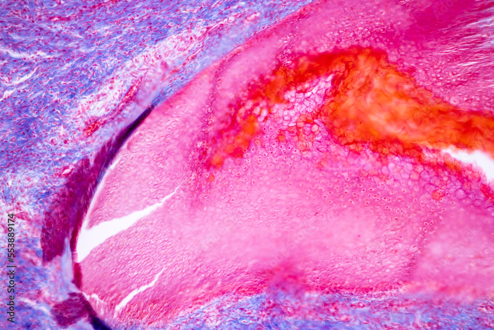 Developing of nail, human embryo under the microscope in Lab. foto de ...