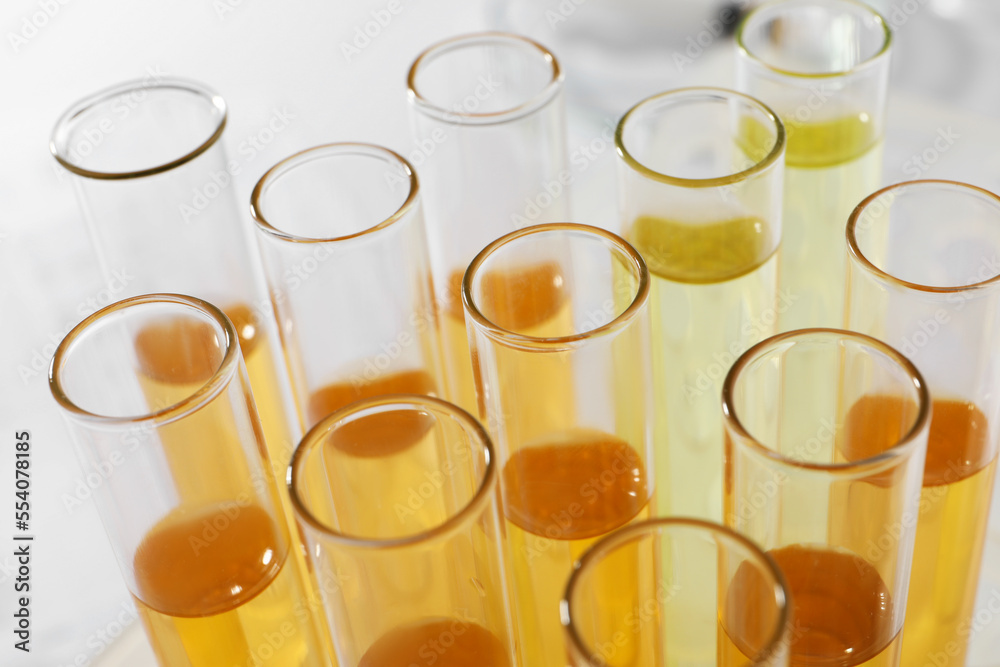 Tubes with urine samples for analysis on blurred background, closeup ...