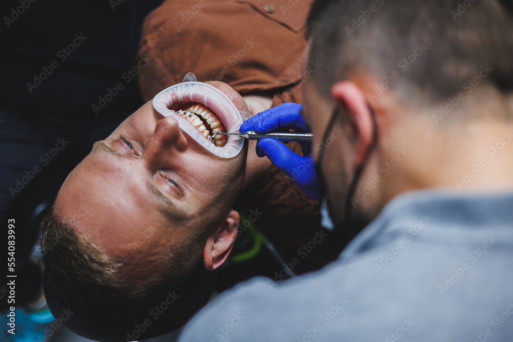 Dental treatment of teeth. A young man at a dentist's appointment. The ...
